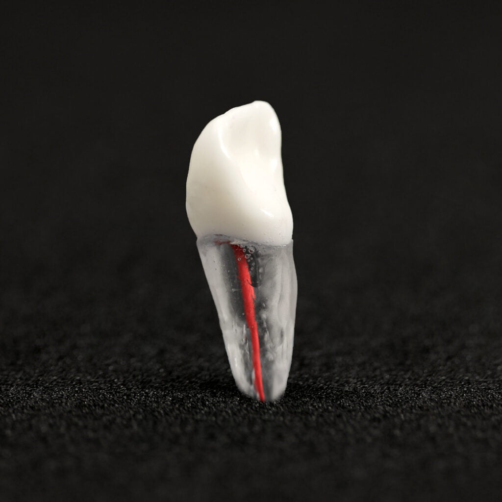 KEDO FILES - KEDO INCISOR MODEL - Alpha Dentkart